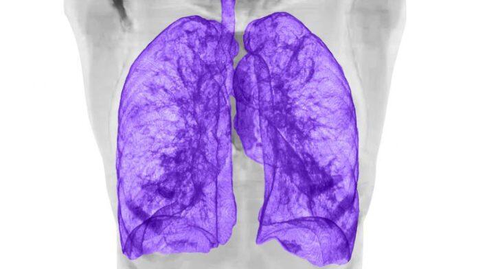 New MRI scanning technology to improve clinical accessibility and ...